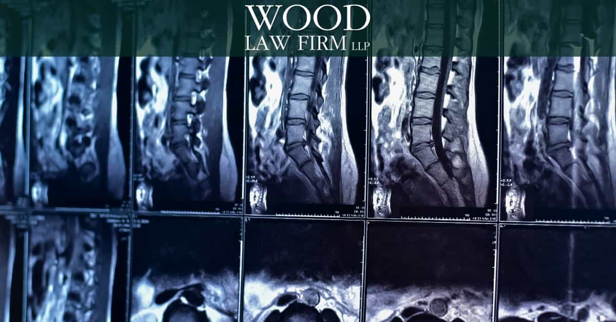 Types of Catastrophic Injuries & Their Causes